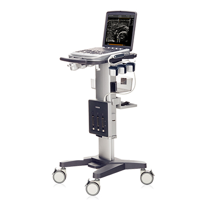 Chison SonoBook 6 portable shared service ultrasound - Med-Tech ...